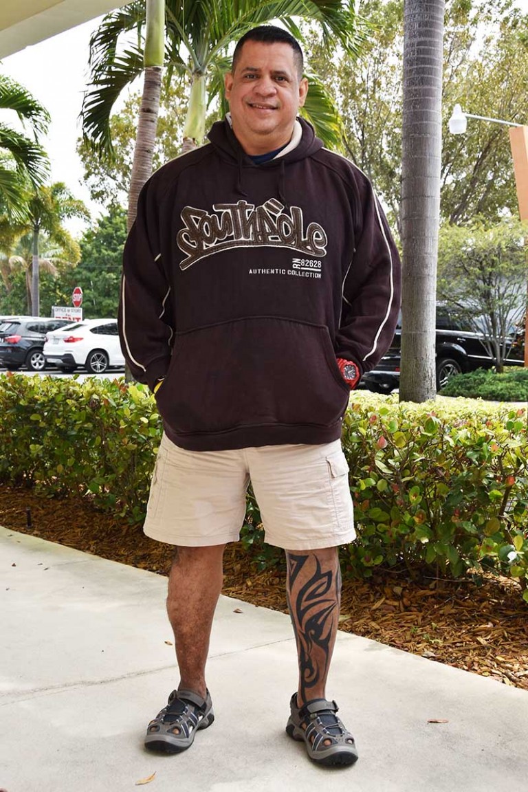 High Definition Silicone Covers | Prosthetic Orthotic Designs